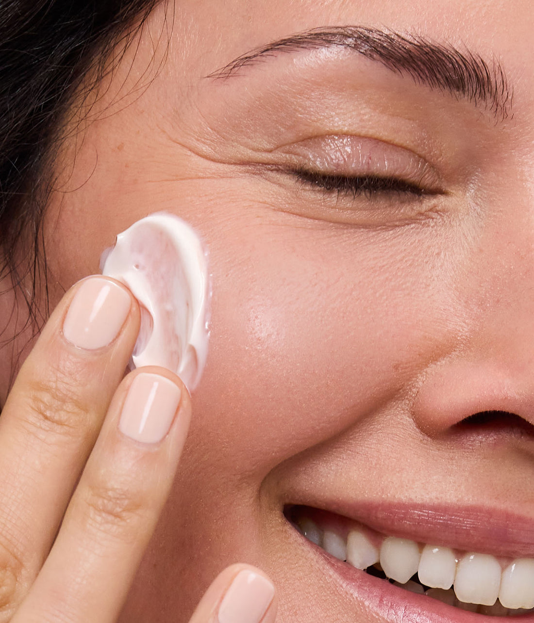 Paracress: The natural alternative to botulinum toxin